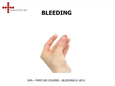 Ppt Bleeding Powerpoint Presentation Free Download Id 2841387