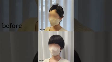 항암치료후 5개월 헤어증모술 20000모 항암붙임머리 항암가발 블랭크유 Youtube