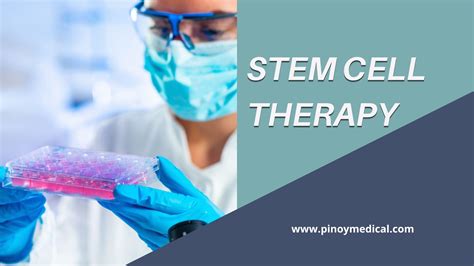 Stem Cell Therapy Price In The Philippines 2025 — Pinoymedical