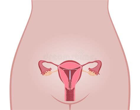 Icono De Doodle De Dispositivo Intrauterino Ilustración Vectorial