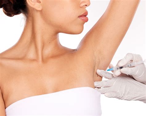 Botox For Hyperhidrosis Benfleet Aesthetics In Benfleet Essex