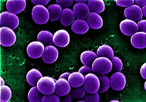 Staphylococcus Aureus Shape Hot Sex Picture