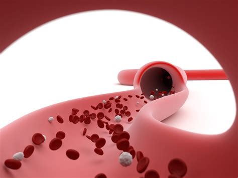 Idiopathic Thrombocytopenic Purpura Itp