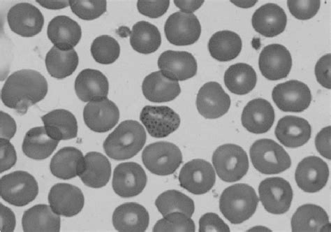 Light Microscopy Of Blood Smear Demonstrating Erythrocyte With Download Scientific Diagram