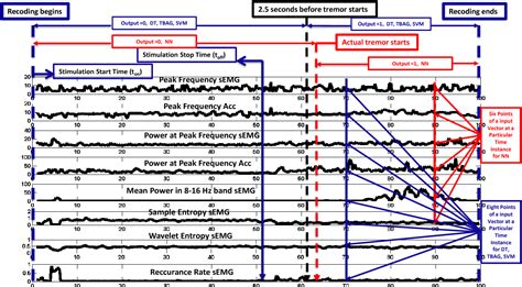 Figure 1 From Machine Learning Technique Based Closed Loop Deep Brain Stimulation Controller