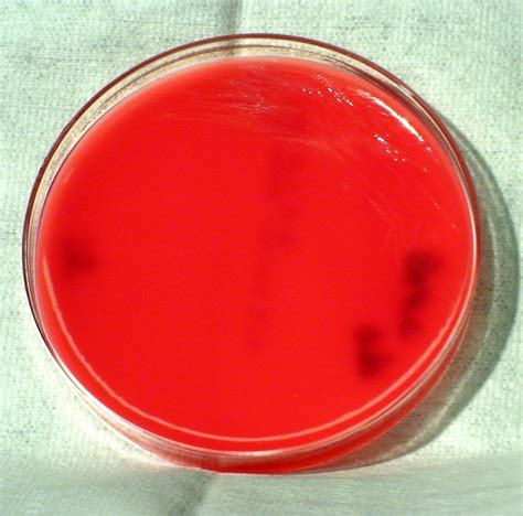 Free Picture Light Colonial Growth Gram Negative Brucella Abortus Bacteria