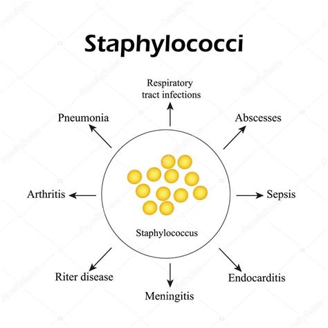 Estafilococos Staphylococcus Aureus Causa Enfermedades Infografías