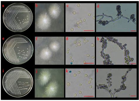 Isolation And Identification Of Fungi With Glucoamylase Activity From Loog Pang Khao Mak A Thai
