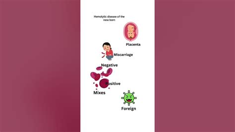 What Is Erythroblastosis Fetalis Hdn Biology Youtube