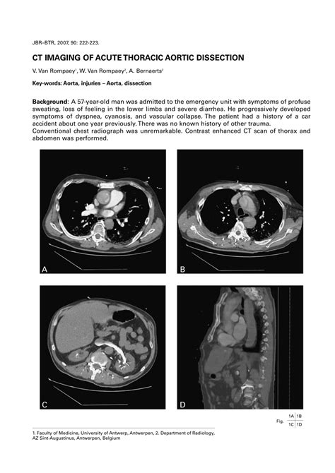 Pdf Ct Imaging Of Acute Thoracic Aortic Dissection