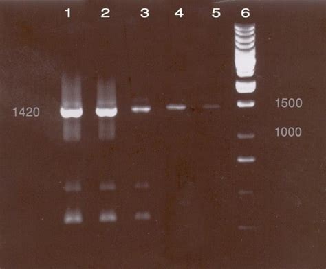 Gel Electrophoresis Of Gradient Pcr Carried Out To Optimize Annealing