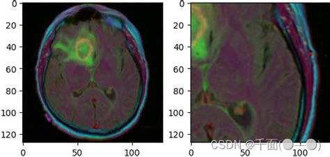 Albumentations医学图像数据增强方式医学图像的数据增强csdn Csdn博客