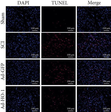 Analysis Of Neuronal Apoptosis A B The Neuronal Apoptosis Was Download Scientific Diagram