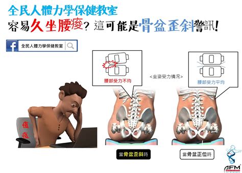 全民人體力學保健教室 【全民人體力學保健教室：你常久坐腰痠嗎 這可能是骨盆歪斜的警訊】