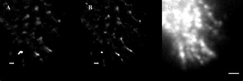 Figure 1 From Super Resolution Imaging Of The Structural Maintenance Of Chromosome Smc