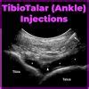 Tibiotalar Joint Injection Ultrasound Sports Medicine Review