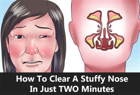 How To Clear A Stuffy Nose In Just Two Minutes Shtfpreparedness