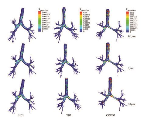 the particle deposition patterns presented by dpm accretion rate in
