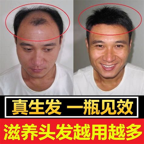 头发秃顶理个什么发型 秃顶寸头发型图片 秃顶理什么发型图片 第4页 大山谷图库