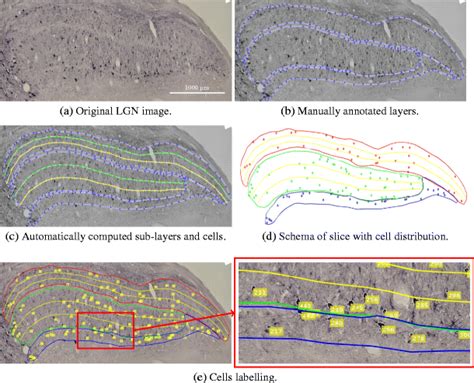 The Stages Of Slice Processing With Cas Download Scientific Diagram