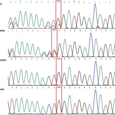 Sequence Analysis Results Of The Mlycd Gene Of The Patient And Her