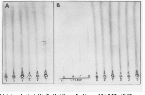 Figure 1 From A Soybean Seed Urease Null Produces Urease In Cell Culture Semantic Scholar