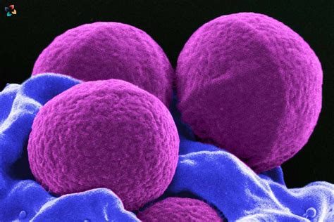 Methicillin Resistant Staphylococcus Aureus Mrsa Overview