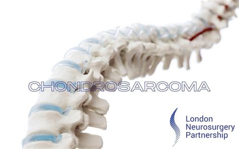 Chondrosarcoma London Neurosurgery Partnership