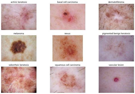 Kenneth Odoh On Linkedin Kensolar On Twitter