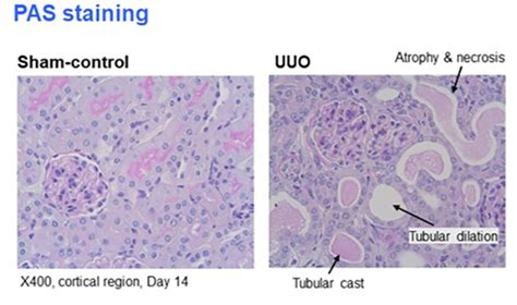 Uuo Induced Renal Fibrosis Model Smc Laboratories Inc