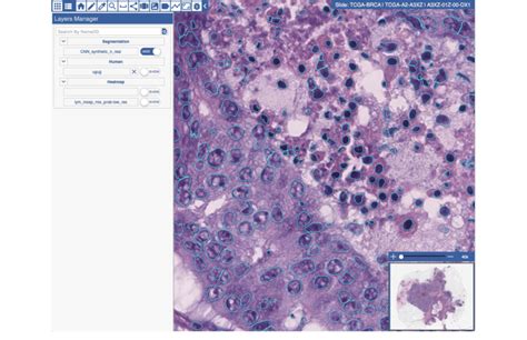 Visualization Of Nucleus Segmentation Results As An Overlay Of Polygons Download Scientific