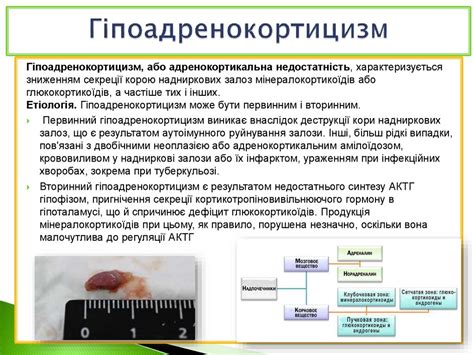 Хвороби ендокринної системи Лабораторна робота №15 презентация онлайн