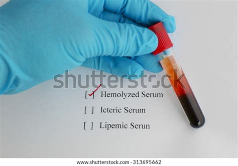 Categoría Hemolyze De Fotos E Imágenes Shutterstock