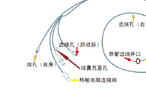 肺动脉导管word文档在线阅读与下载无忧文档