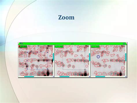 Melanie 2d Gel Analysis Software Pdf