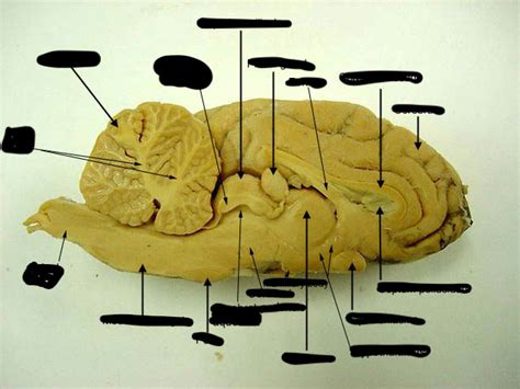 Anatomy Sheep Brain Labeling Diagram Quizlet