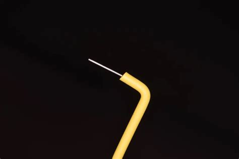 Operculectomy Treatment For Wisdom Teeth Everything You Need To Know