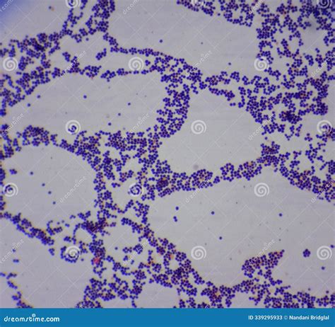 Staphylococcus Aureus Stock Image Image Of Bacterium 339295933