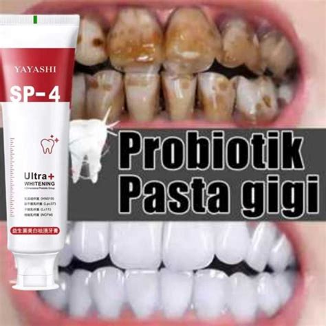 Jual Whitening Toothpaste Pasta Gigi Probiotik Sp 4 Gigi Putih Pasta Gigi Whitening Pasta Gigi