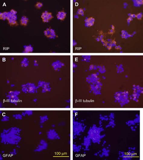 Expression Of Various Markers Of Neural Cell Differentiation As