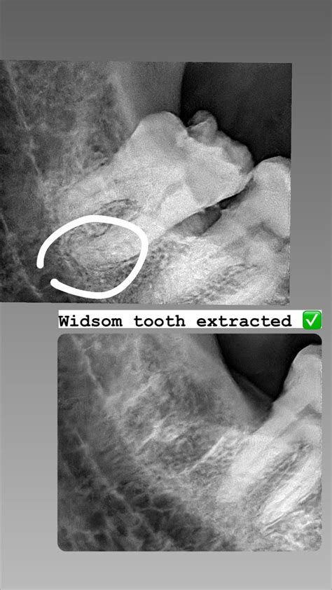 Done Houssam Alhusseini