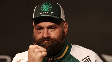 Фюрі пішов на радикальні кроки після поразки від Усика Читайте на Ukr Net