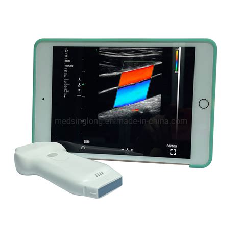 Portable Linearconvexphased Array Double Head Probe Wireless Color Doppler Ultrasound Scanner