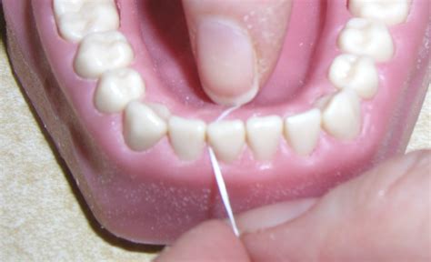 Reynolds Dentistry FLOSSING