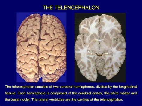 SOLUTION Lecture 20 Functional Anatomy Of The Cerebral Cortex 1 Studypool