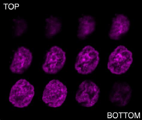 Confocal Optical Sectioning Of The Nucleus Of A Living Saos 2 Cell Download Scientific