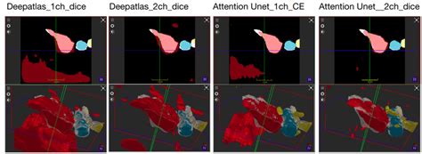 Top Row 2d Cross Sectional View Of The Predictions Overlaid Over The Download Scientific