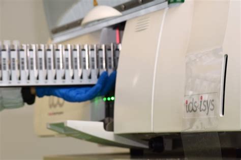 Immunodiagnostic Systems Ids On Linkedin Immunoassay