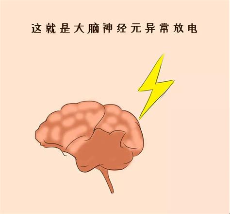 漫画癫痫是怎么发生的 搜狐大视野 搜狐新闻
