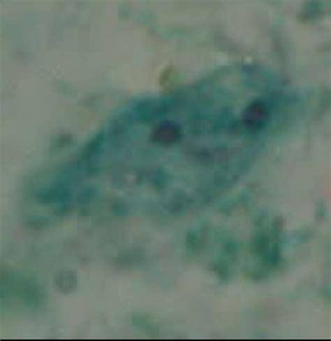 Trofozoito De Dientamoeba Fragilis Hamster